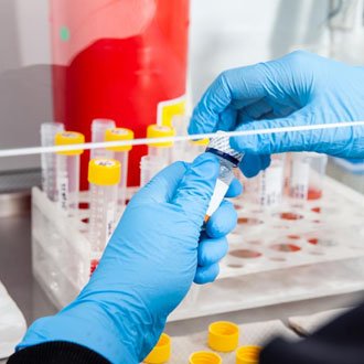 Molecular Diagnostic